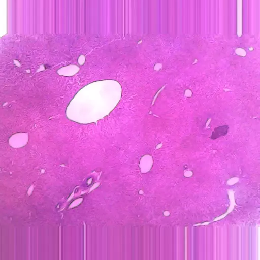 MICROSCOPE SLIDE - Insect trachea