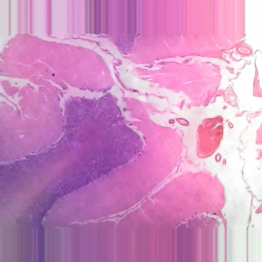 MICROSCOPE SLIDE - Insect trachea