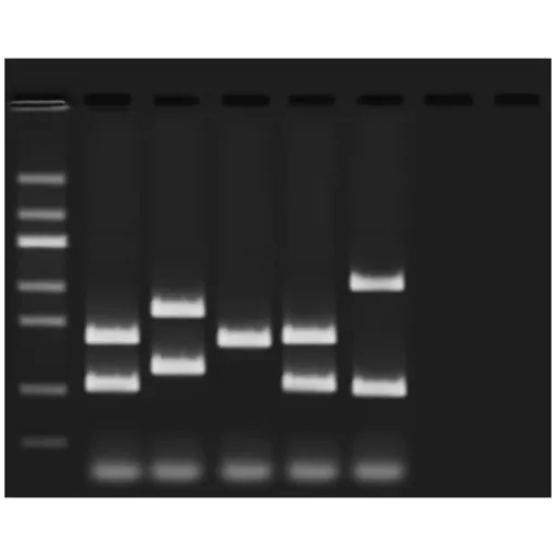VNTR Human DNA Typing Using PCR