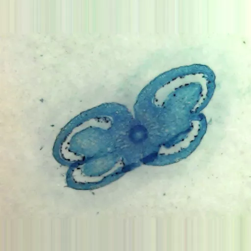 MICROSCOPE SLIDE - Insect trachea