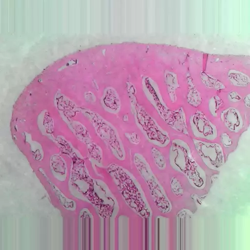 MICROSCOPE SLIDE - Insect trachea