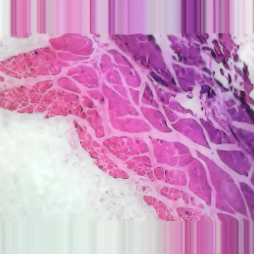 MICROSCOPE SLIDE - Striated muscle I.S.