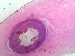 MICROSCOPE SLIDE - Insect trachea