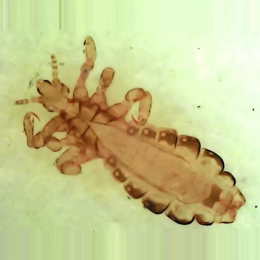 MICROSCOPE SLIDE - Insect trachea