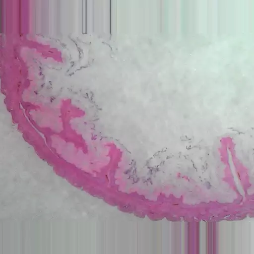 MICROSCOPE SLIDE - Insect trachea