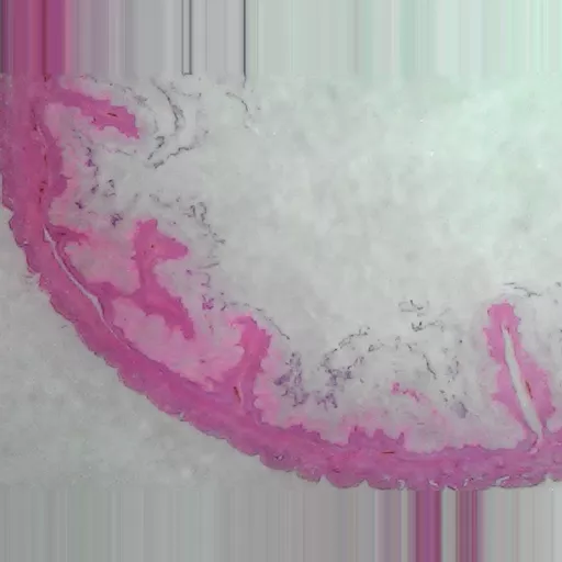 MICROSCOPE SLIDE - Insect trachea