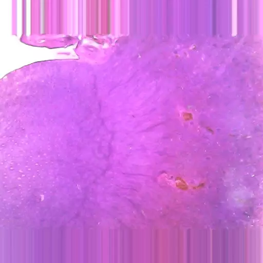 MICROSCOPE SLIDE - Insect trachea