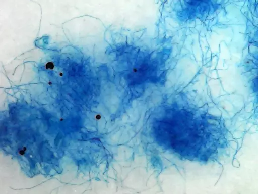 MICROSCOPE SLIDE - Insect trachea