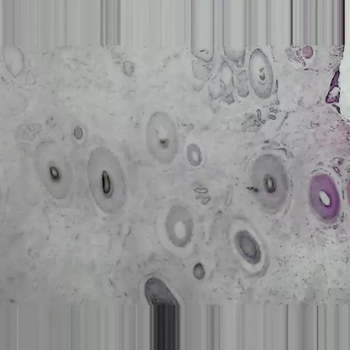 MICROSCOPE SLIDE - HUMAN SKIN