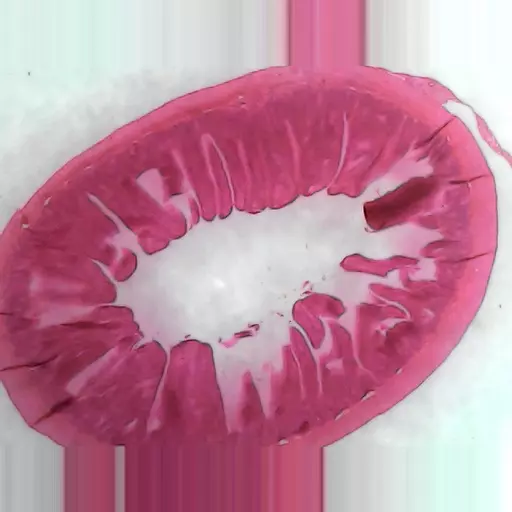 MICROSCOPE SLIDE - Insect trachea