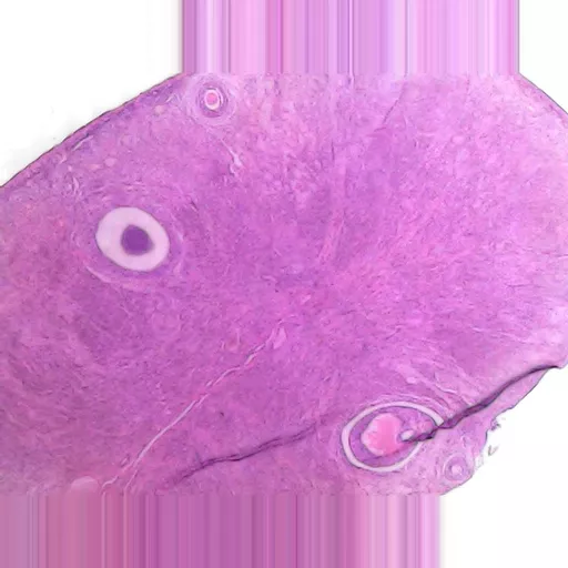 MICROSCOPE SLIDE - Insect trachea