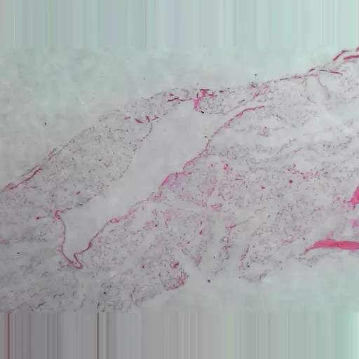 MICROSCOPE SLIDE - Adipose tissue section H.2-2