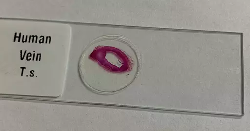 MICROSCOPE SLIDE - Insect trachea